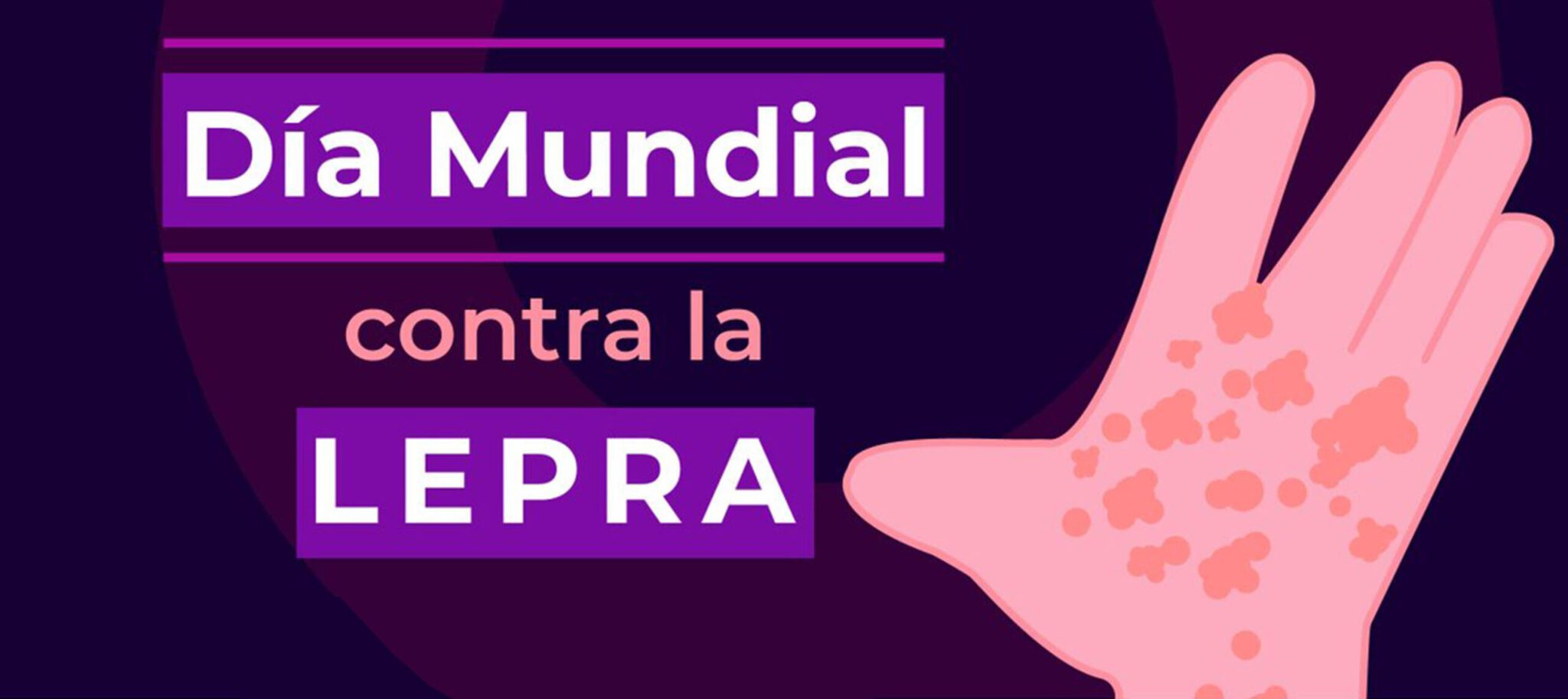 Día Mundial de la Lepra – 26 de enero – Colegio Externado de San José